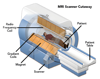 Enhancing MRI Systems with PIN Diodes in Medical Imaging | Microwave ...